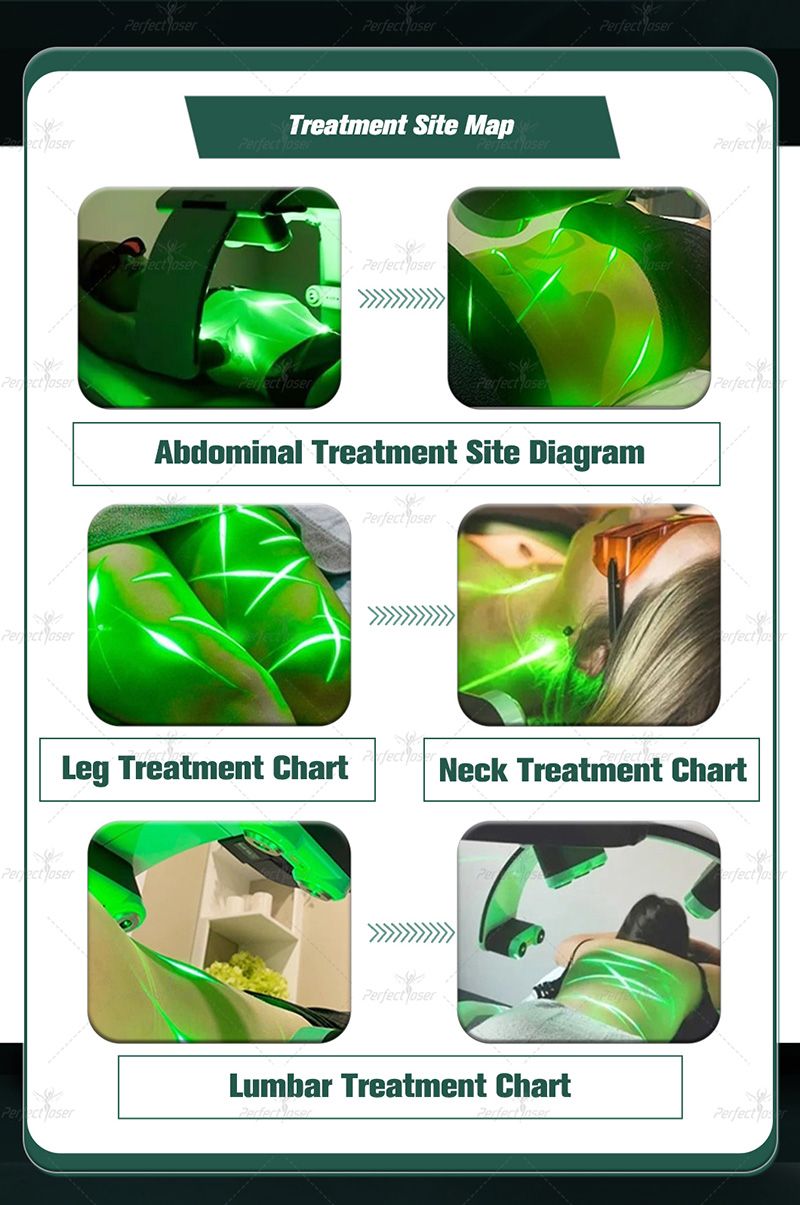 Laser Fat Reduction Brings You a Different Weight Loss Experience: