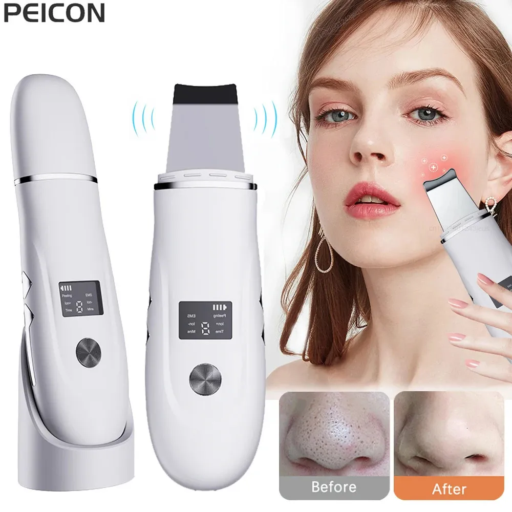 Ultrasonic Face Scrubber Facial Peeling Skin Scrubber Deep Facial ...