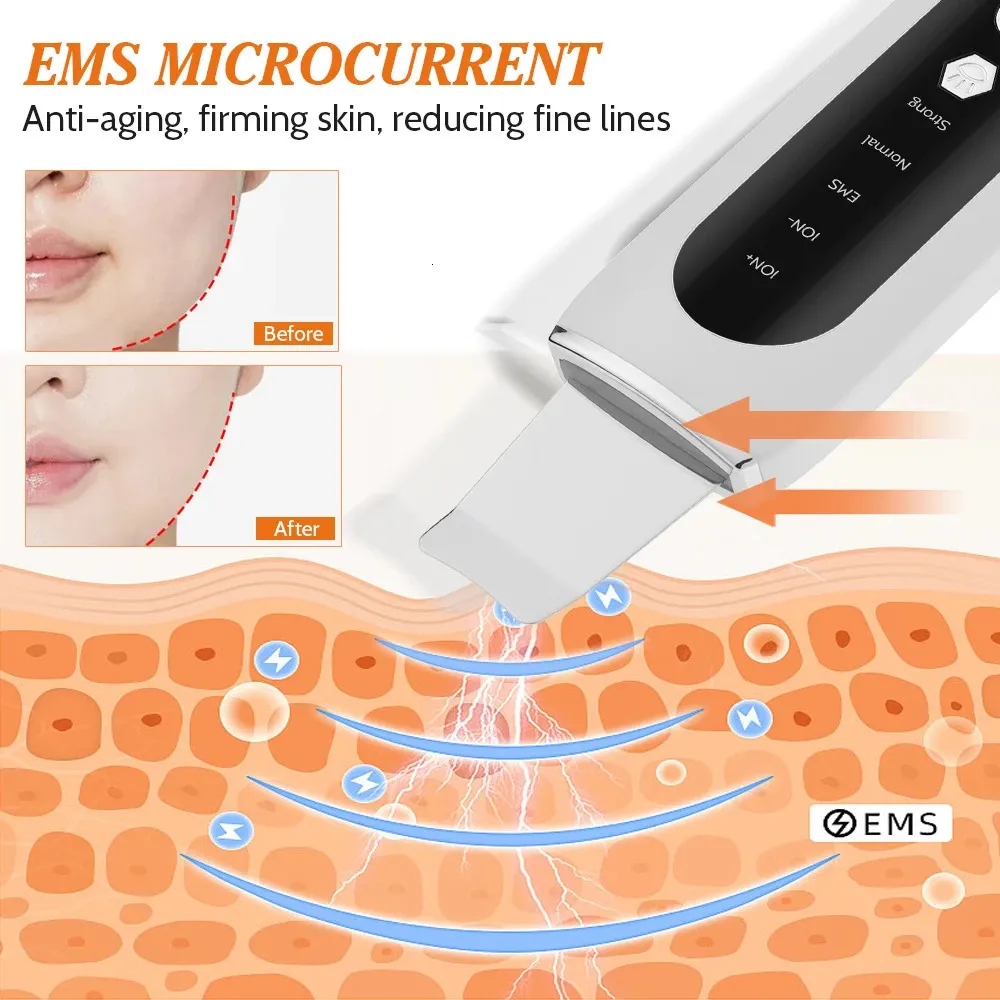LED EMS Ultrasonic Facial Skin Scrubber Pore Cleaner with Nano Mist ...