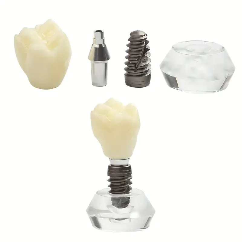 DHgate.com:Single Crystal Dental Implant Model Detachable Teeth Crown ...