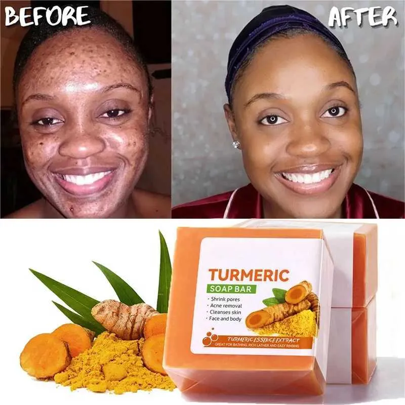 Turmeric Soap Bar - Handmade for Bright, Smooth Skin. Deep Cleansing ...