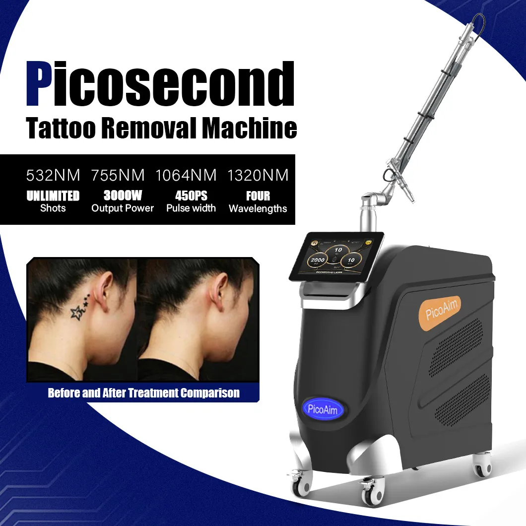Picosecond laser machine for Pigment Removal, Tattoo Removal and Skin ...