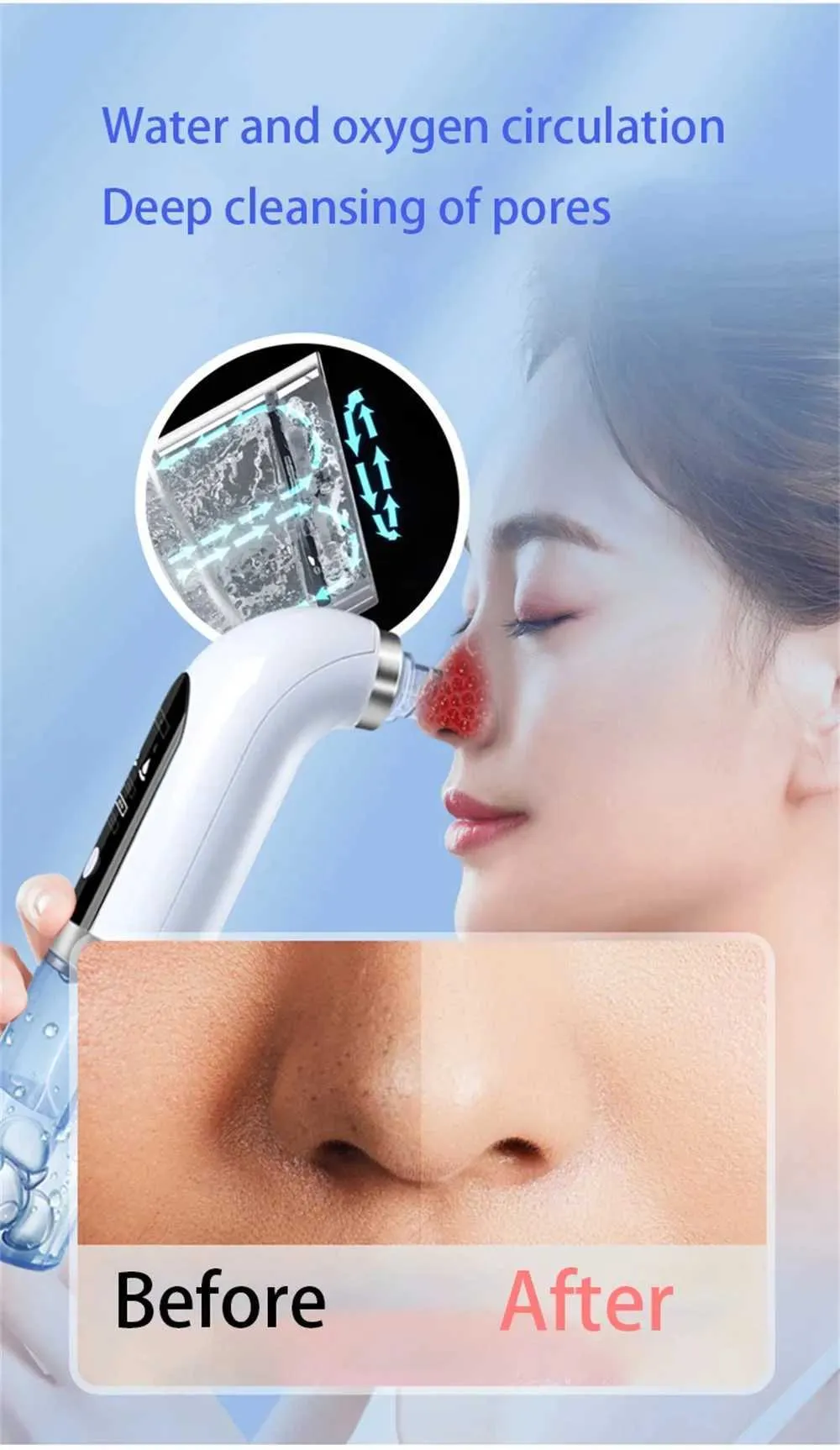Electric Pore Cleaner: Blackhead Extractor Vacuum for Flawless Skin ...