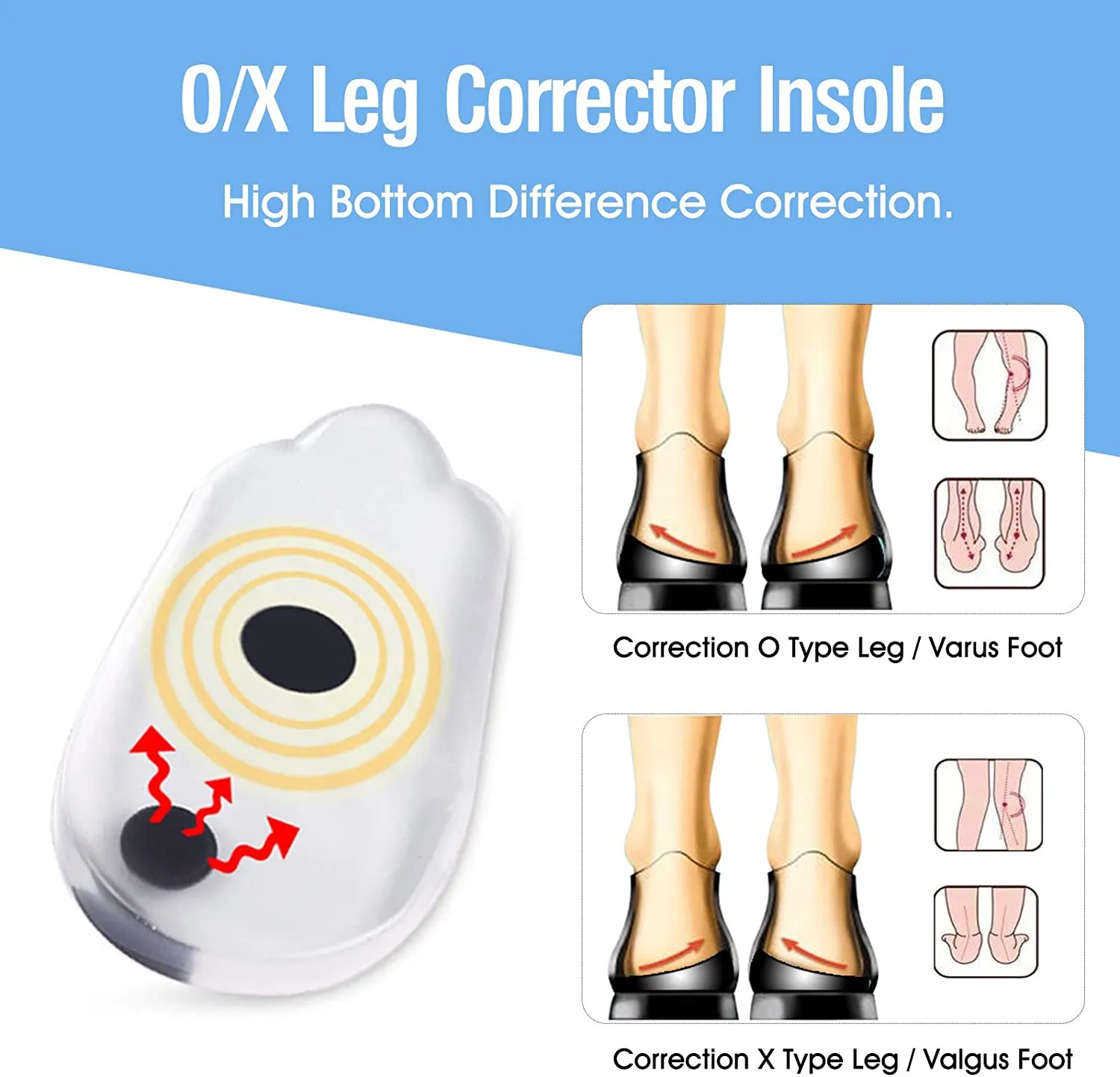Magnetic Silicone Orthopedic Insoles for Foot Care - Men & Women - O/X ...