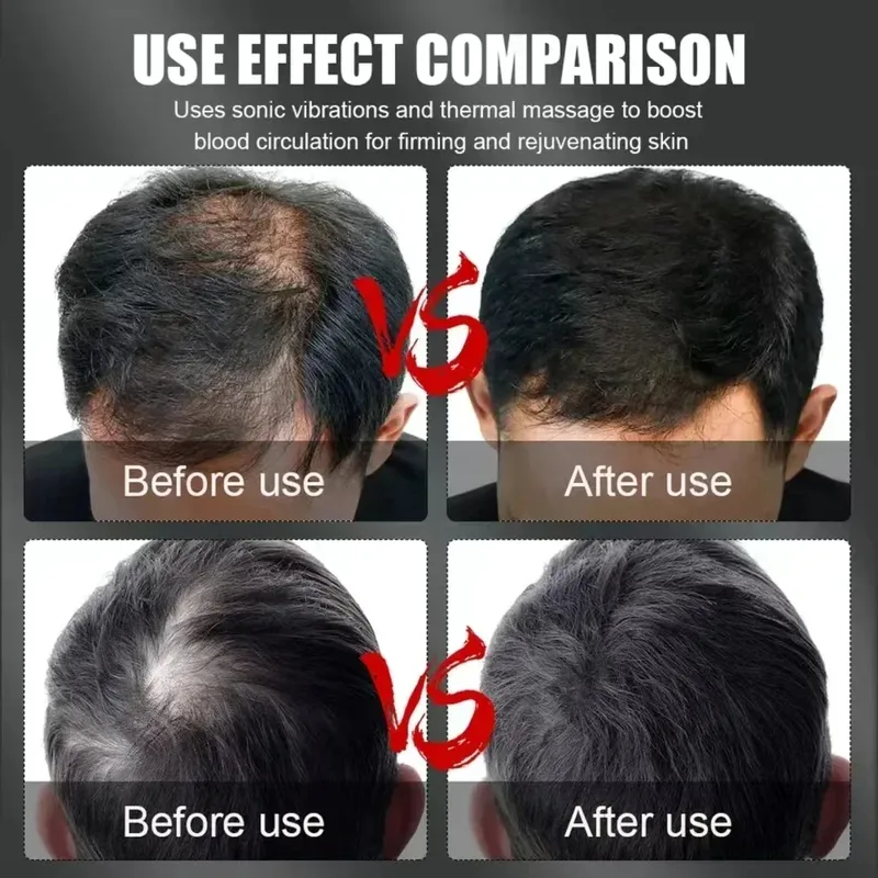 Anti Hair Regrowth For Men Loss Scalp Care Hat For Improved Hair ...