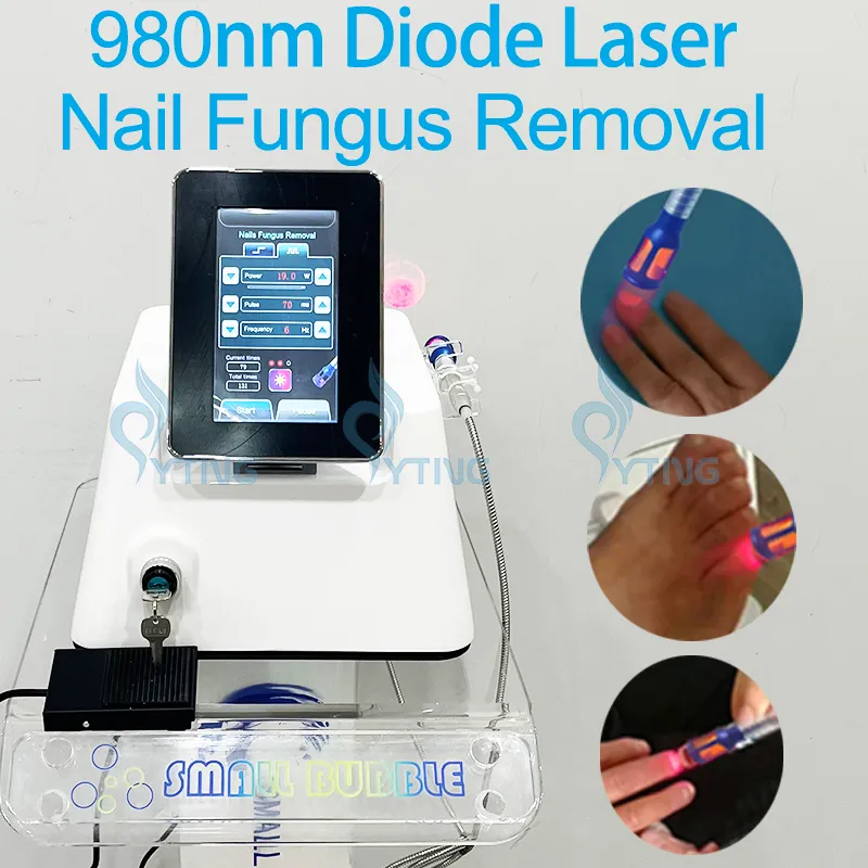 Onychomycosis Toenail Fungus Remover 980nm Laser Machine Spa, Salon ...