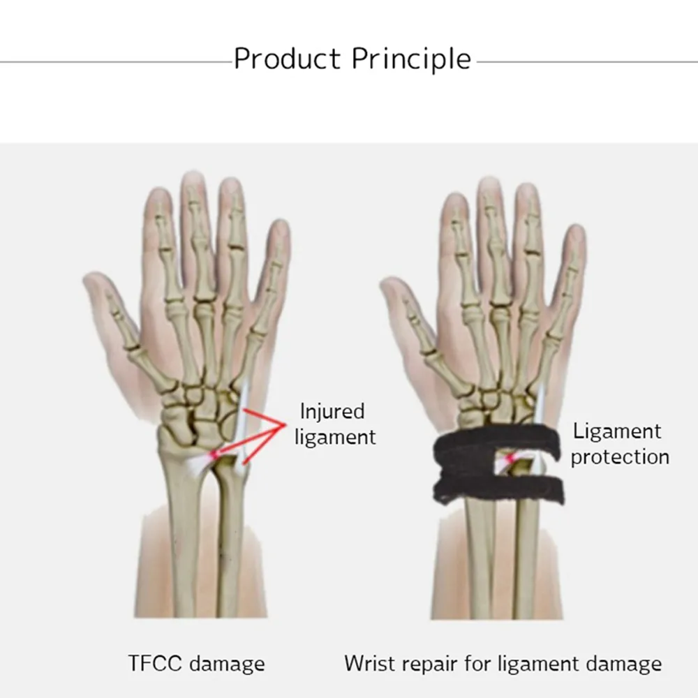 Adjustable Support Wrist Brace for TFCC Tear and Ulnar Sided Wrist Pain ...