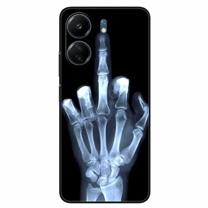 For Xiaomi Poco C65 Case, Soft Silicone Cool Wolf TPU Phone Cover, 6.74 ...