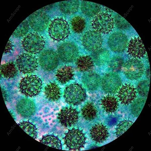 phase contrast microscopy virus