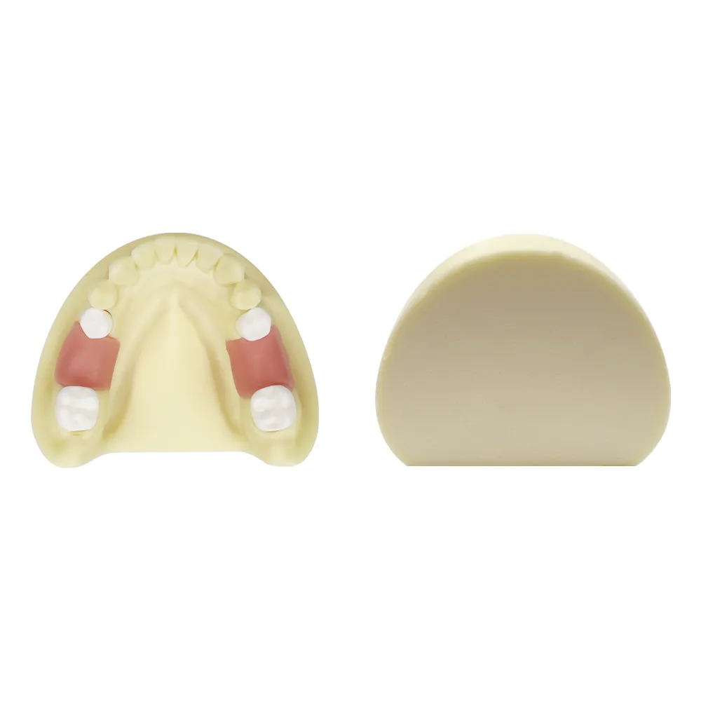 DHgate.com:Mandibular Dental Implant Practice Model: Missing Teeth ...