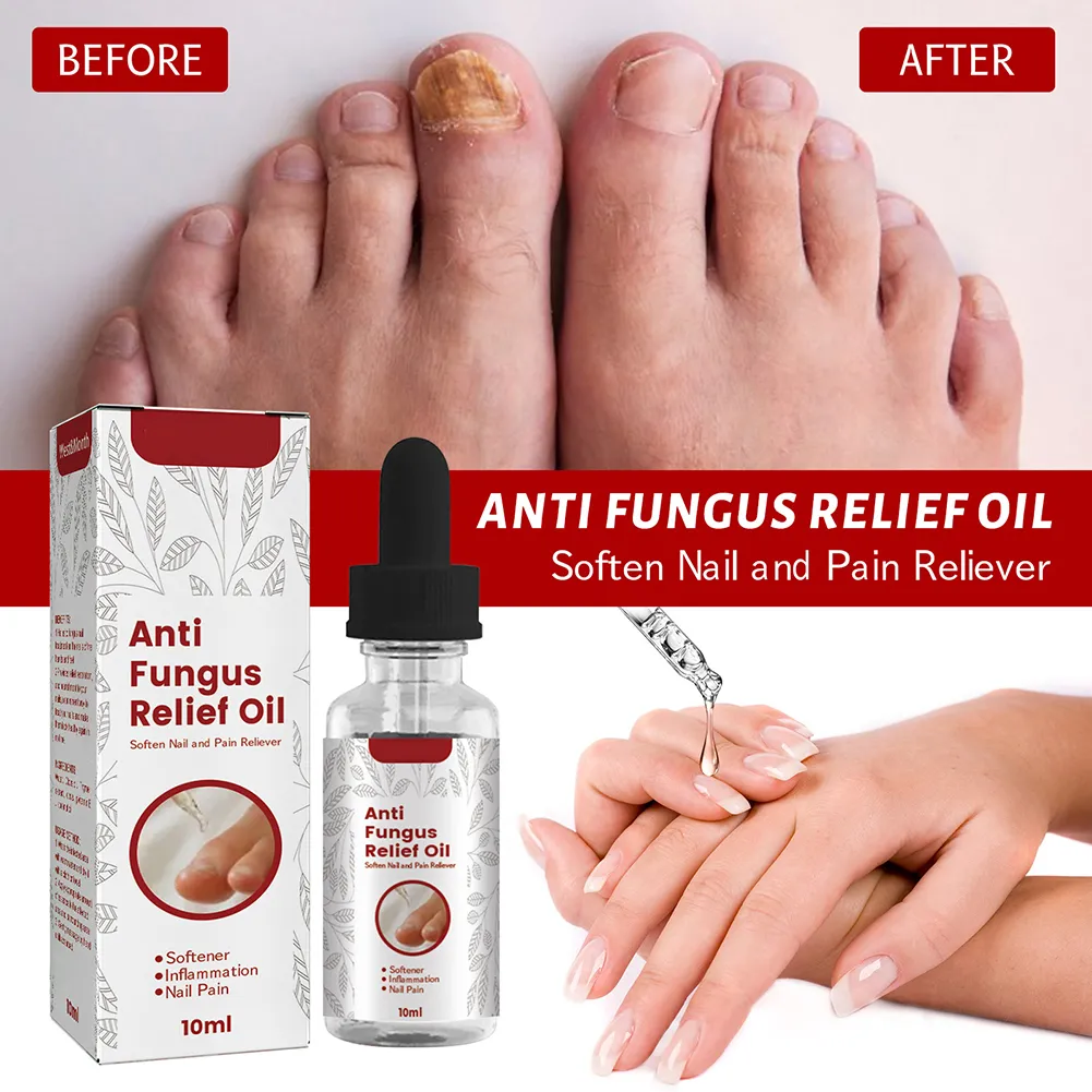 Onychomycosis Relief Oil Natural, Mild, Non Irritating For Finger & Toe ...