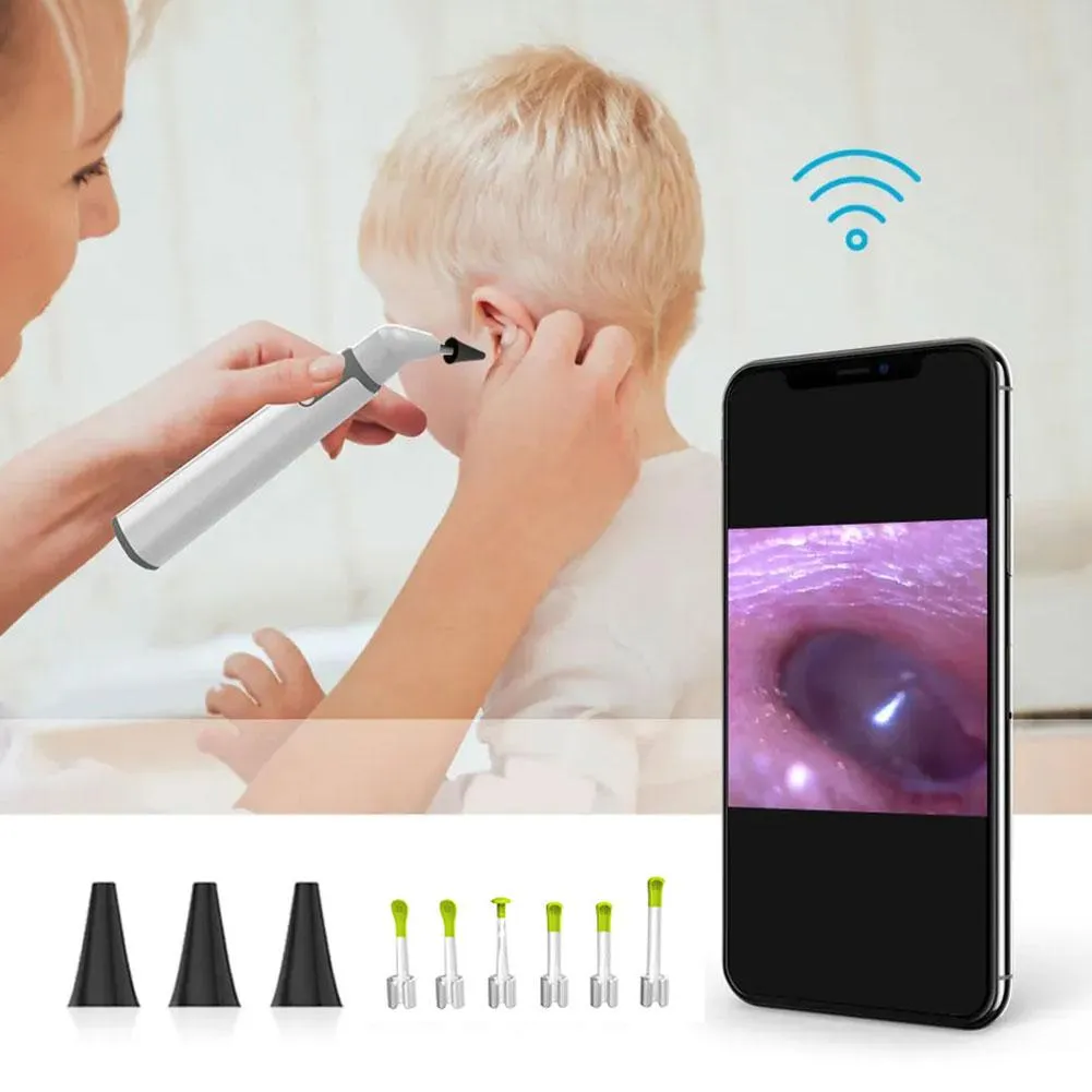 Wifi Otoscope Visual Ear Endoscope Camera Medical Ear Wax Cleaner ...