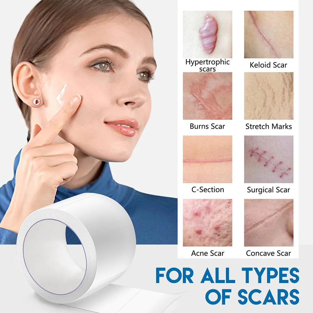 Silicone Gel Scar Removal rough patch for Acne, Trauma, and Skin Repair ...