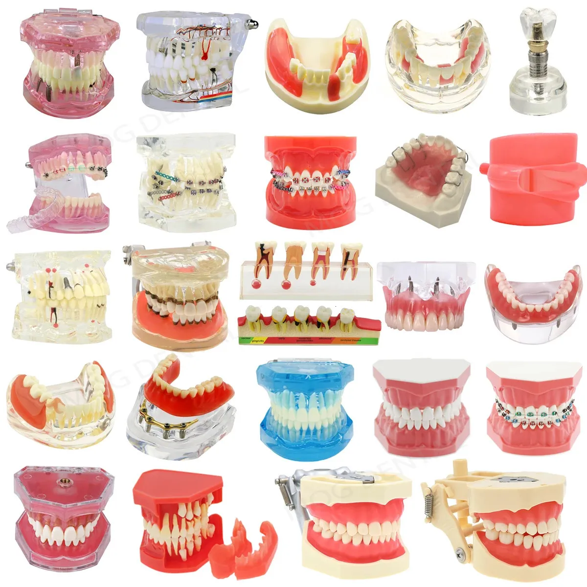 Dental Model Implants Detachable Dental Education Model For Laboratory ...