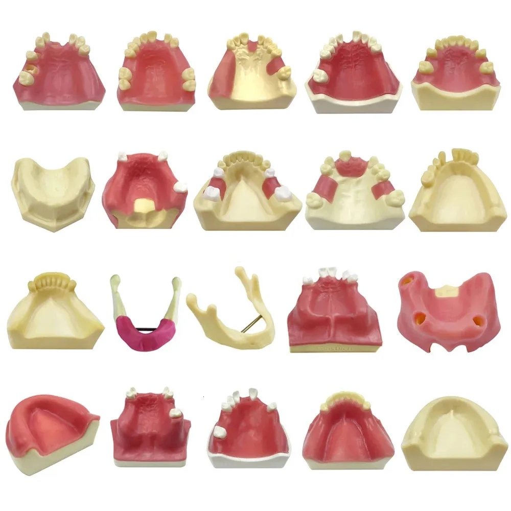 Anatomical Teeth Models: Maxillary Mandibular Model With Sinus & Soft ...
