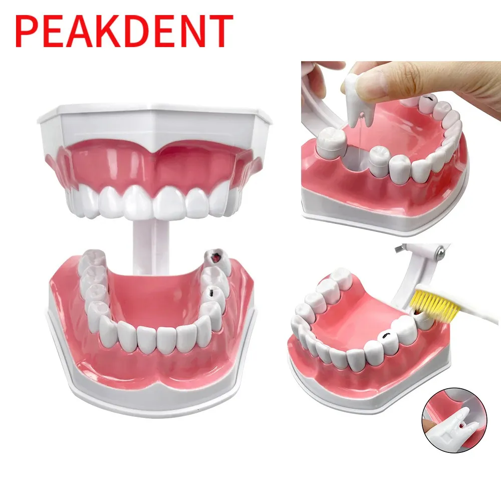 Standard Dental Tooth Models Removable Dental Caries Teaching Tools For ...