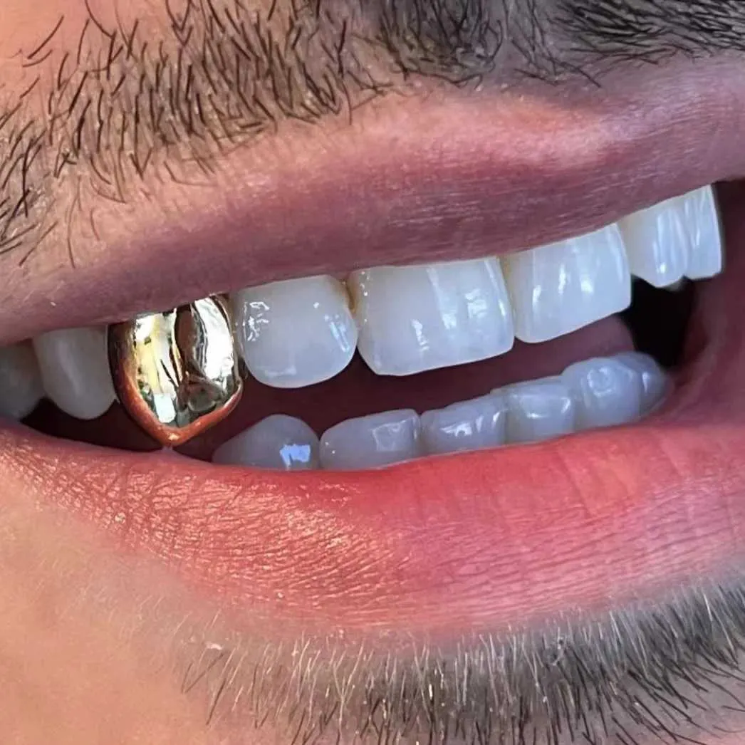 Diamond Grillz Teeth: Single Tooth Cap, 14K Gold Plated, Glossy Finish ...