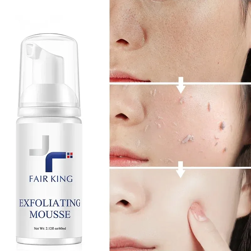 DHgate.com:FAIR KING Skin Purifying Exfoliating Mousse for Deep Pore ...
