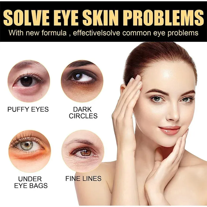 CELYN Eye Cream: Reduce Dark Circles, Tighten & Lift,... From Longda007 ...
