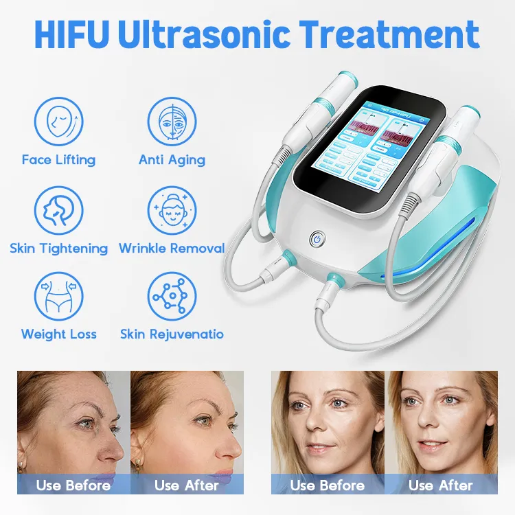 Professional 9D Vmax RF Beauty Device for Face Lifting and Wrinkle ...