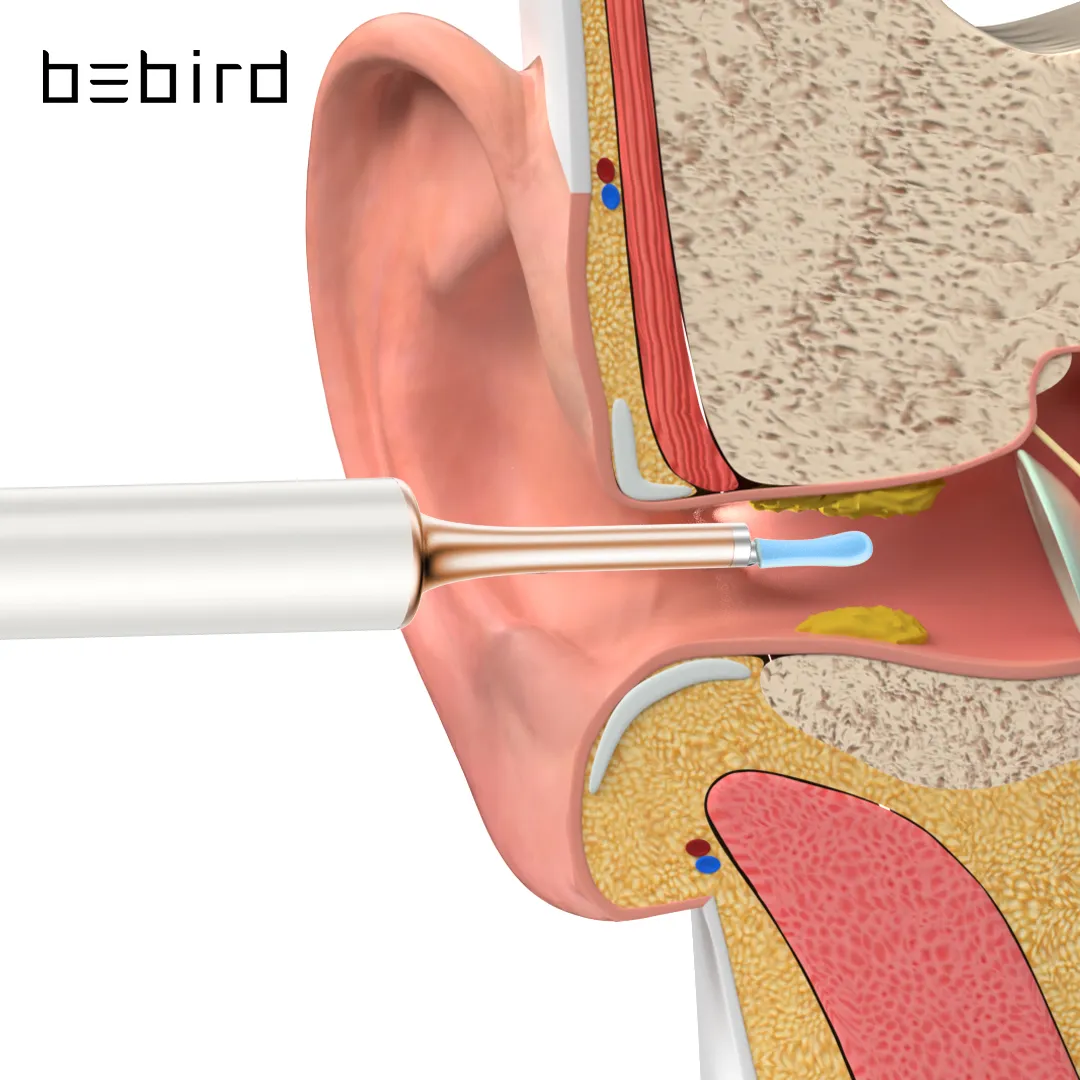 DHgate.com:Bebird T15 R1 Visual Ear Cleaner Health Care Minifit 2in1 ...