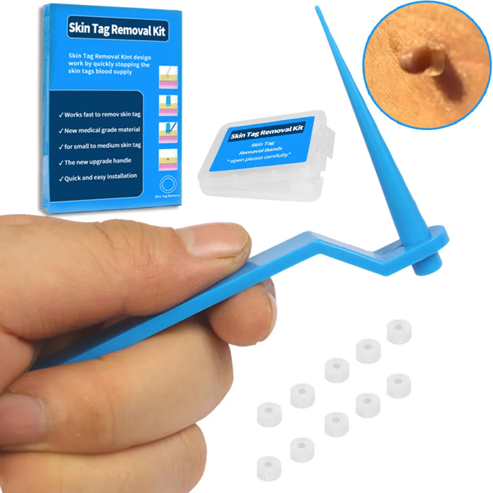 Papilloma Skin Tag Mole Wart Remover Kit Micro Skin... From Ddmycrazy ...