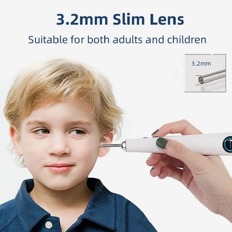 DHgate.com:[2024] 3.2mm Thin Lens Digital Otoscope: 1080P HD 10.1" Big ...