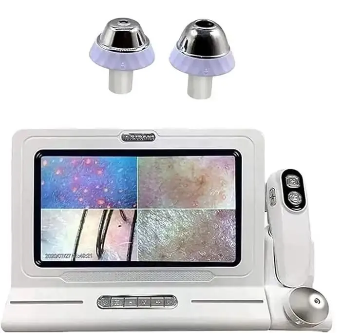 High Quality HD 3D Portable Scalp Scanner Detector: 3D Hair Analyzer ...