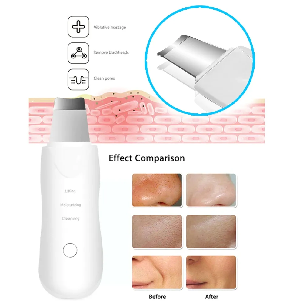 2024 Electric Waterproof Face Scrubber - Ultrasonic Deep Cleaning ...