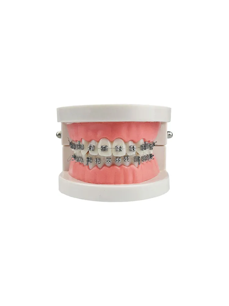 Wholesale Orthodontic Teeth Model With Full Metal Bracket And Ortho ...