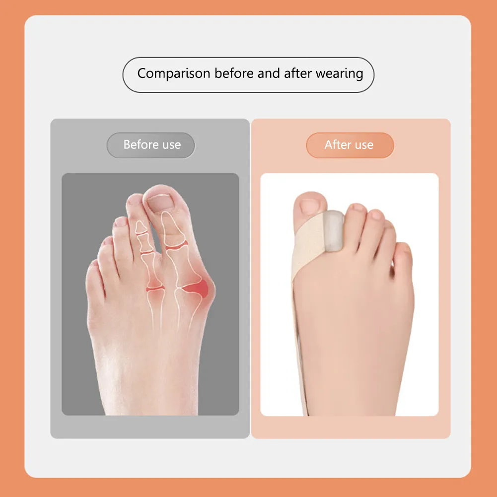 Unisex Thumb Bursitis Relief Strap For Daily Wear Relieve Pain, Split ...