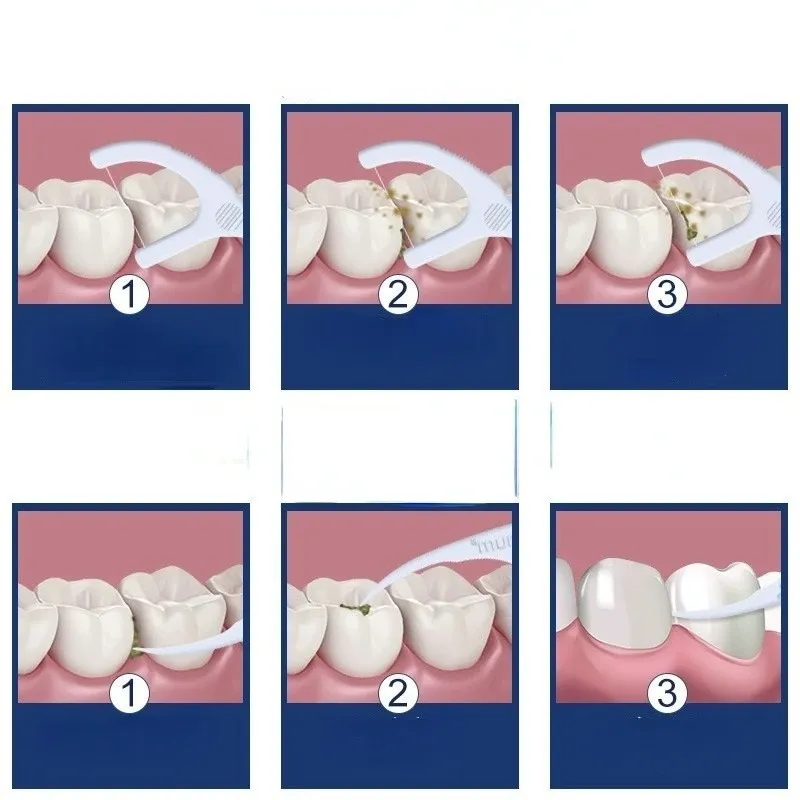 e Dental Flosser L Shape Teeth Whitning Elasticity Interdental Brush ...