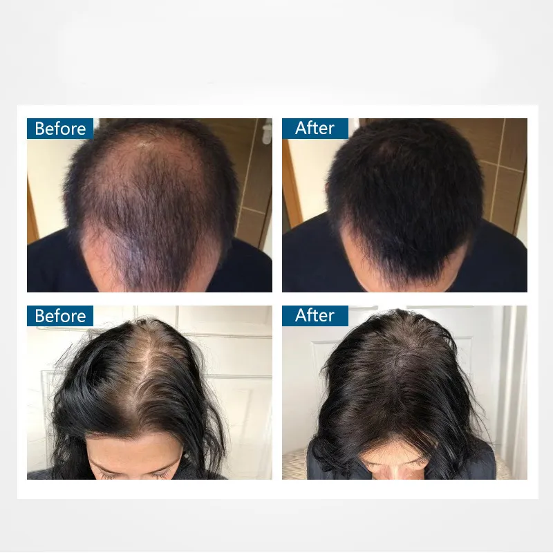 Keratin Hair Fiber Powder Hair Building Fiber Spray for Instant Hair Thickening Regrowth
