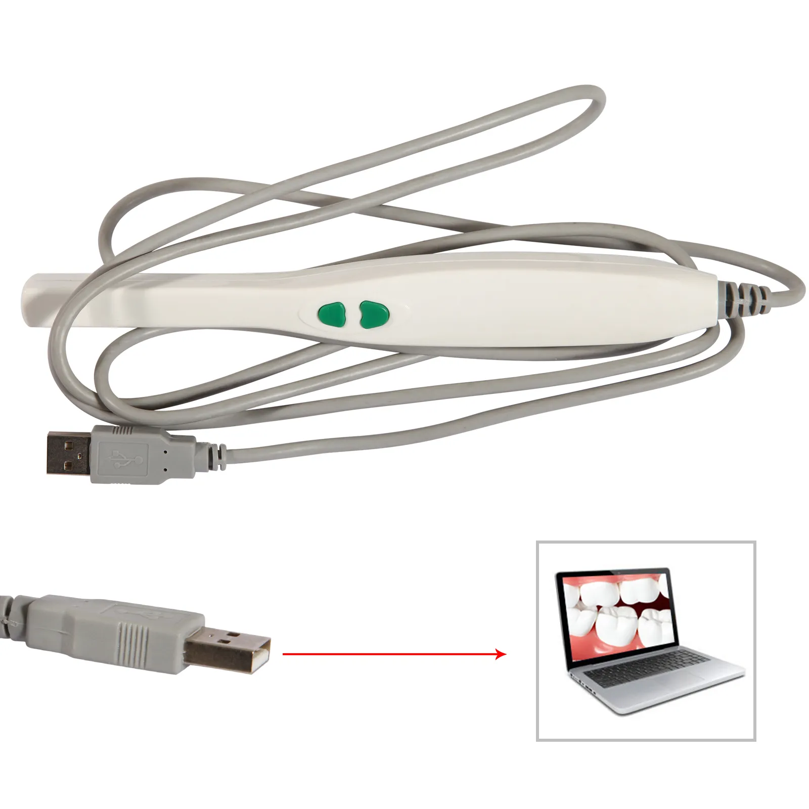 6 LED Dental Intraoral Camera USB 2.0 Imaging, Vista/XP/2024 Compatible ...