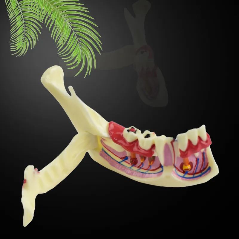 Dental Endodontic Mandible Tissue Anatomical Model Dental Endodontic ...