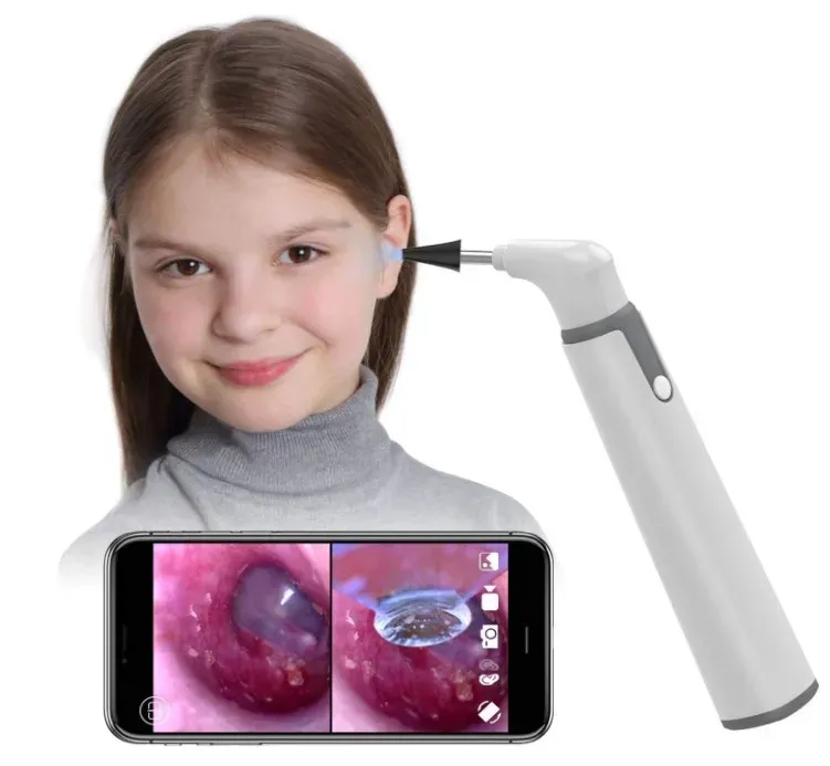 Wi-Fi Visual Otoscope Ear Camera - 3.9mm Earwax Cleaner for Ears, Nose ...