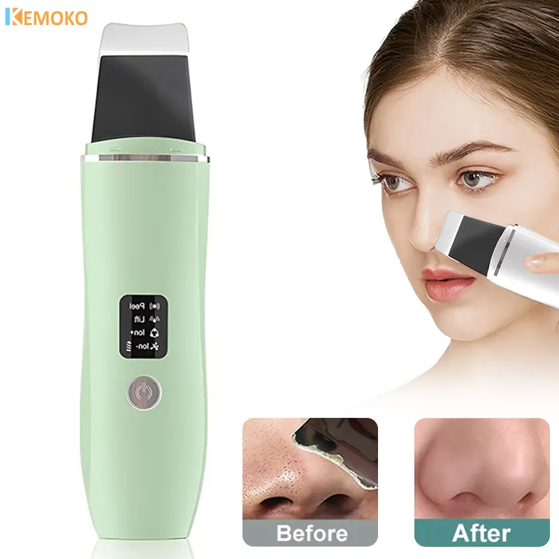 Ultrasonic EMS Skin Scrubbers Face Pore Cleaner For Blackhead Removal ...
