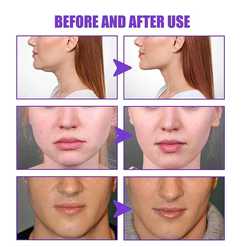 Face V Shape Lift Slim Cream for Double Chin Reduction and Facial ...