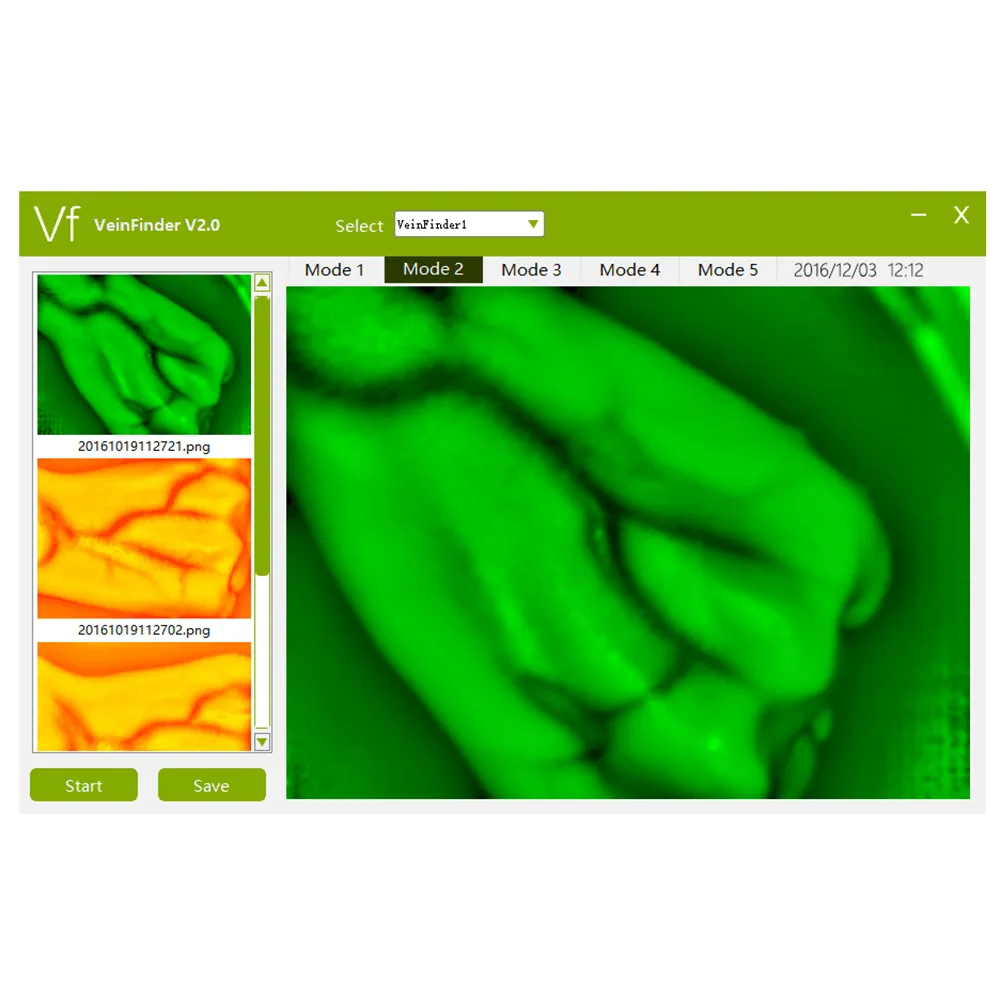 Vein Viewer Device with USB Interface for Arm Imaging and Medical ...