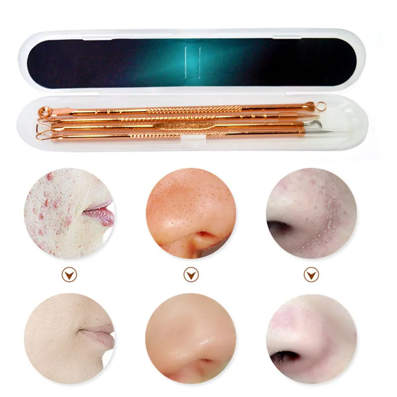 Blackhead Remover Kit for Spot Pimple Blemish, Professional Stainless ...