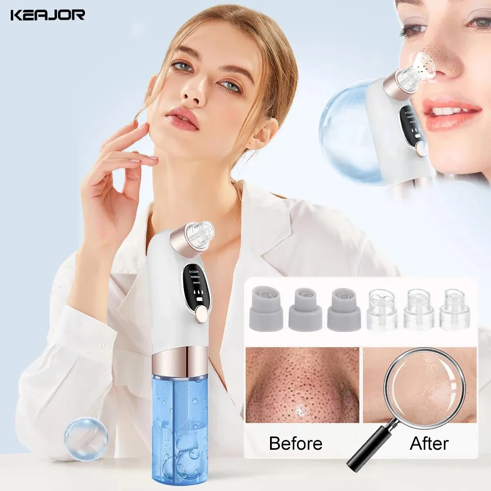 Electric Blackhead Remover Vacuum for Face and Nose Skin with Water ...
