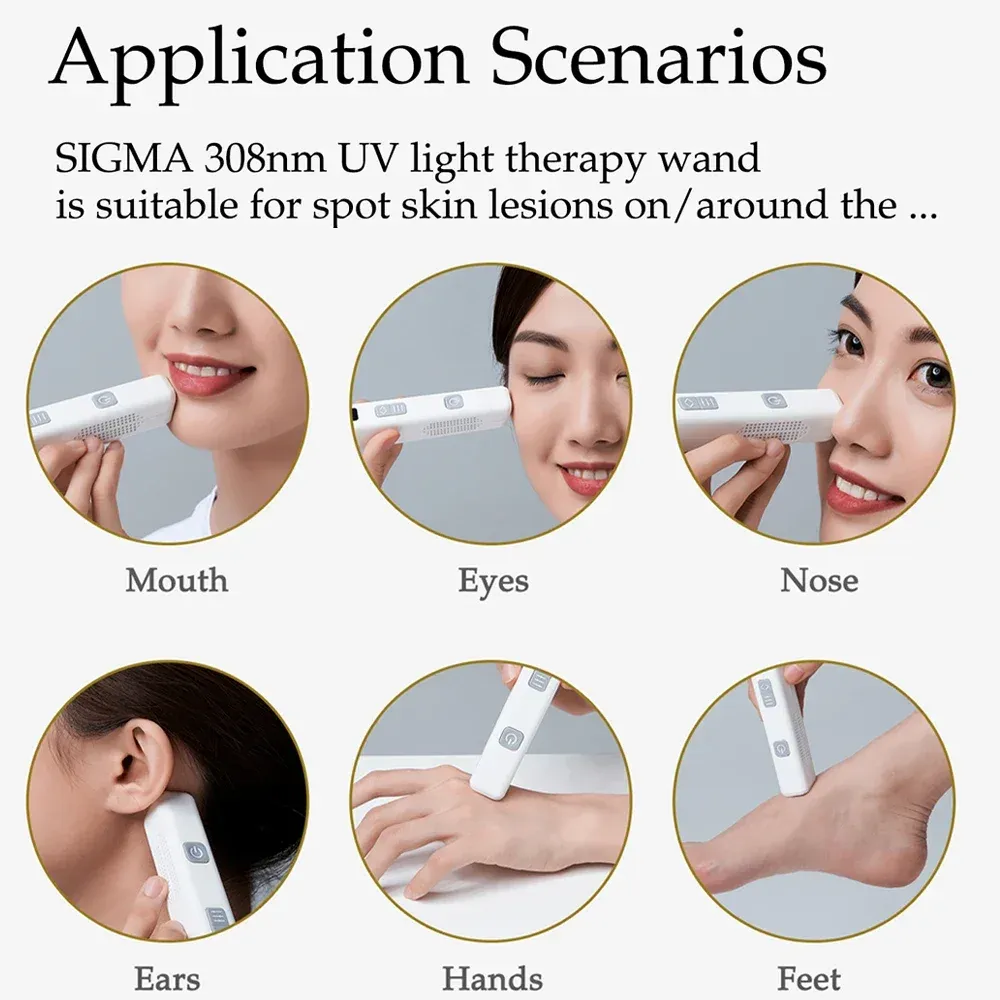 DHgate.com:308nm UV Phototherapy Device Portable Spot Treatment for ...