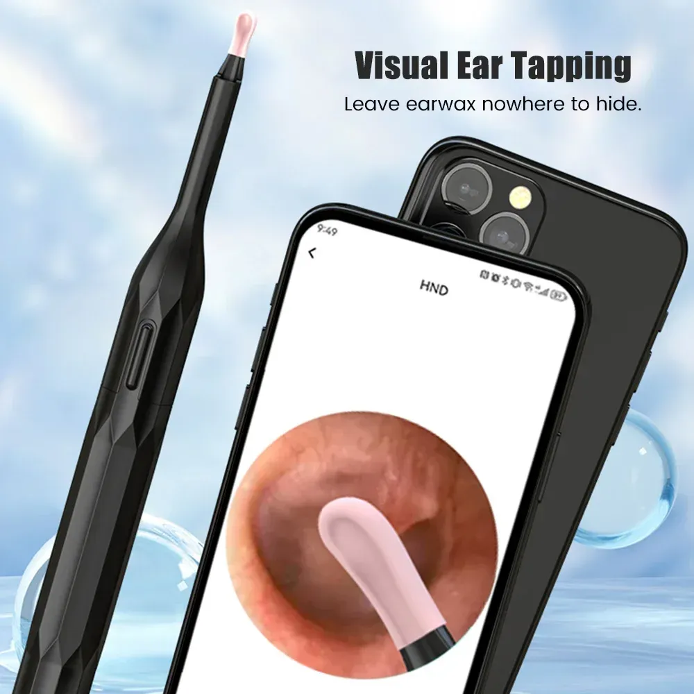 Wi-Fi HD Otoscope Camera Ear Wax Removal Tool with LED - Black from ...