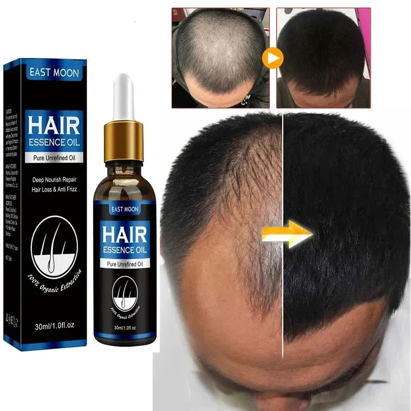 DHgate.com:Rapid Hair Growth Oil: Natural Treatment for Alopecia ...