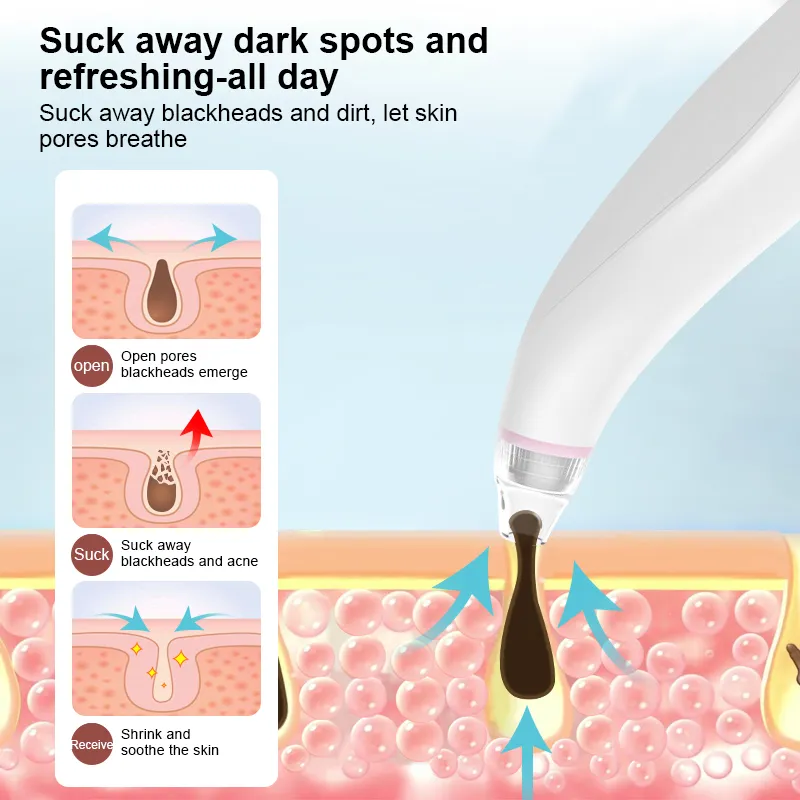 2024 Electric Facial Pore Vacuum Cleaner for Deep Cleansing - Blackhead ...