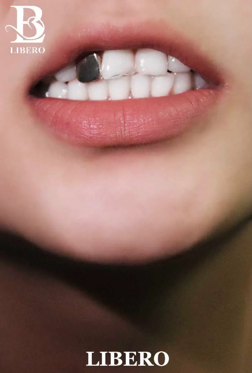 Smooth Single Tooth Grilz - Comfort Brace for Enhanced Style - Shop Now ...