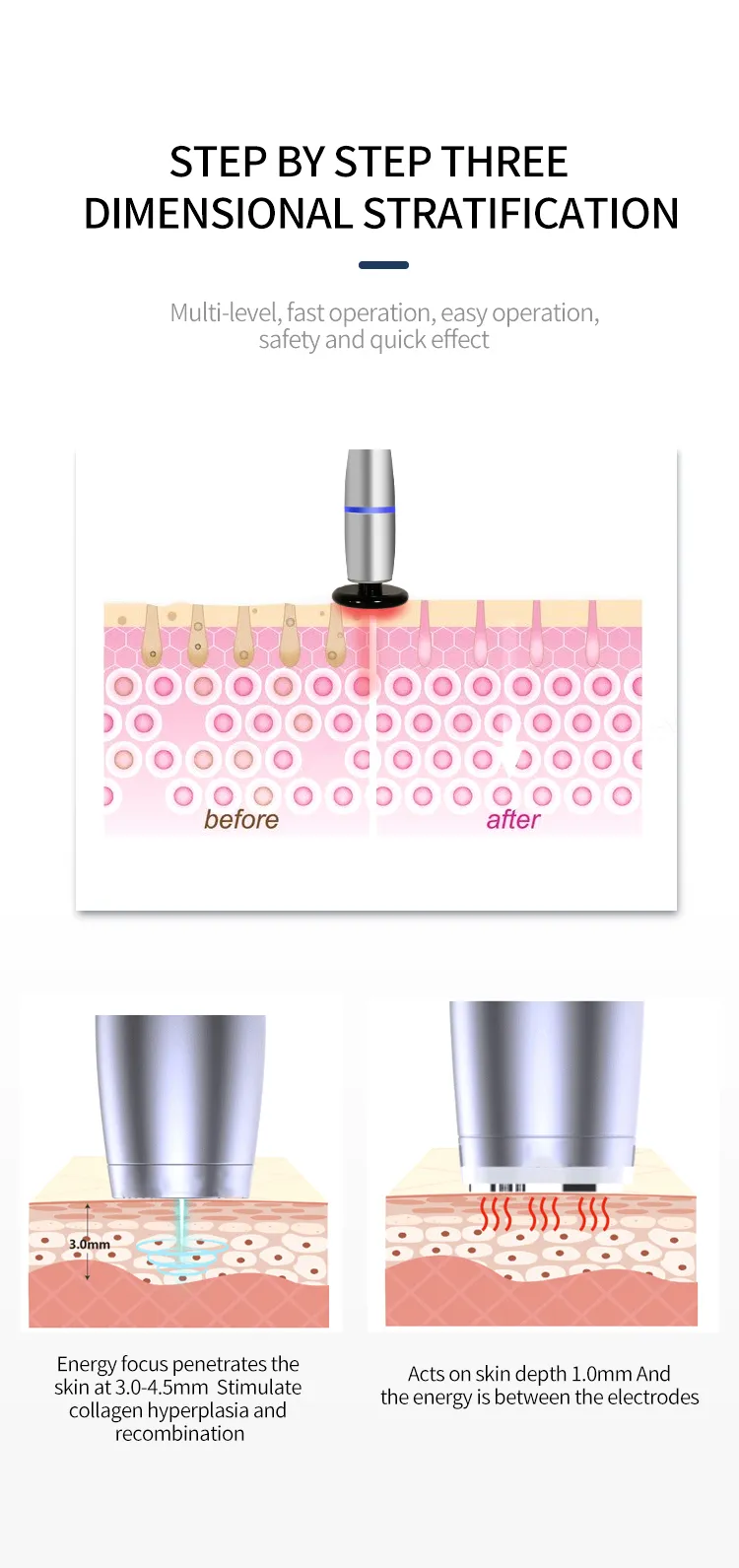 Ultrasonic Face Lifting Device with Ice Hammer & RF: Anti-Aging ...