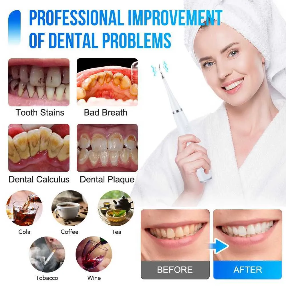 Sonic Electric Dental Calculus Remover Kit - Plaque & Tartar Removal ...