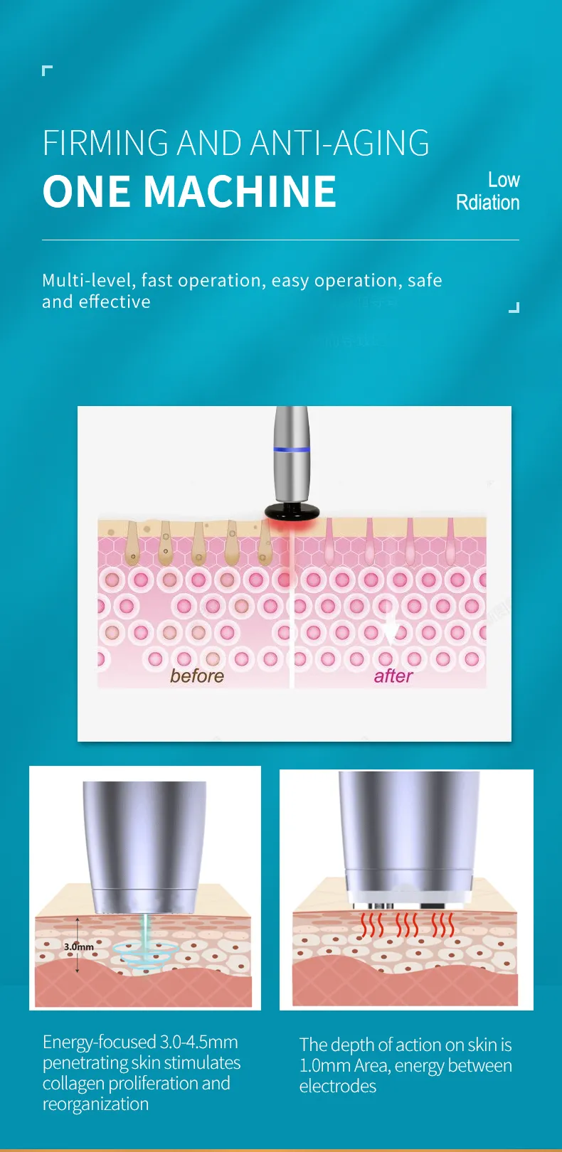 Portable RF and Ultrasonic Face Lift Machine with 4 Handles for Skin ...