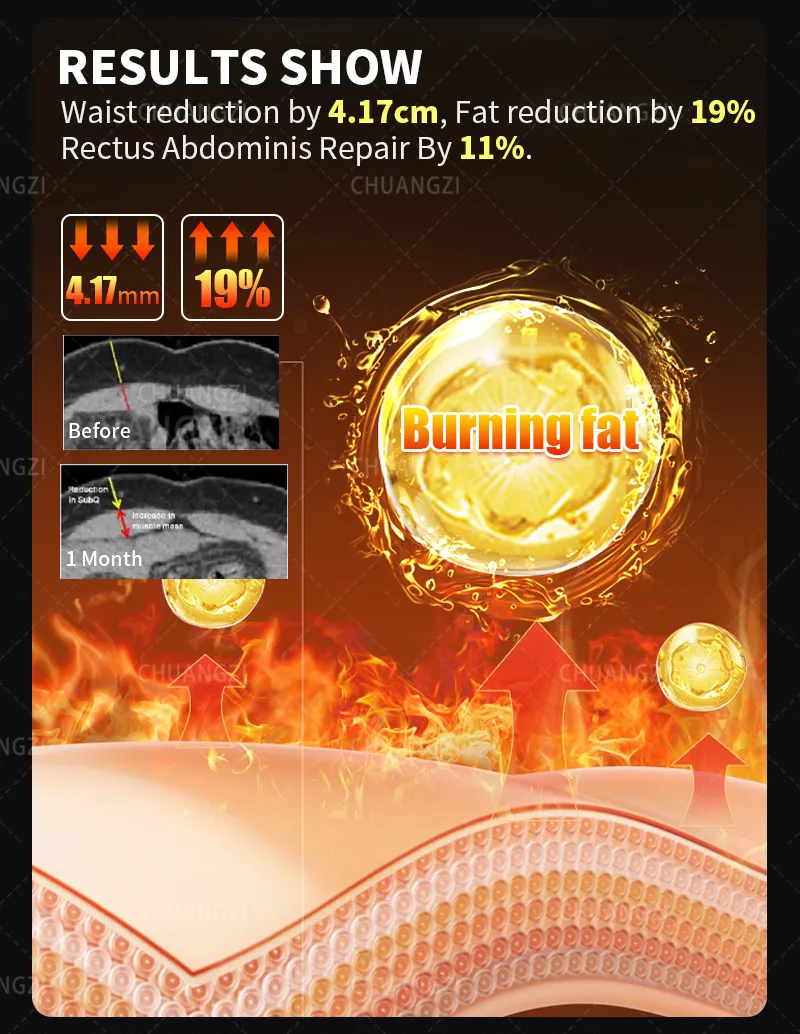 2023 Hot EMSZERO PRO SLIMMING 6500W 15 TESLA EMSlim NEO HEALTH ...